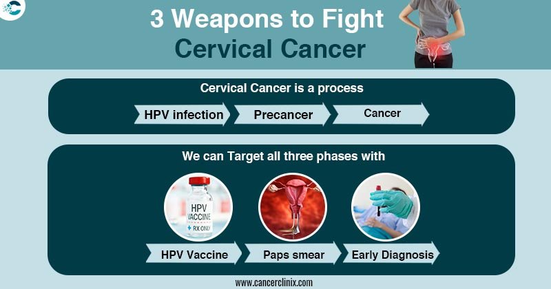 Cervix Cancer Specialist in Ahmedabad suggest 3 Weapons to fight it ...