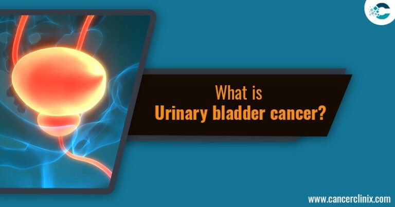 Bladder tumour is common, says Urinary Bladder Cancer Doctor in ...