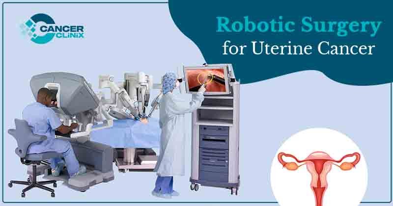 Centres performing Robotic Surgery for Uterus Cancer in Ahmedabad ...