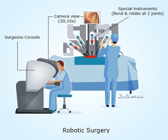 Centres performing Robotic Surgery for Uterus Cancer in Ahmedabad ...